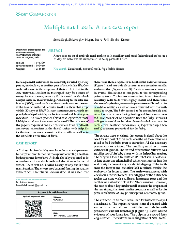 (PDF) Multiple natal teeth: A rare case report