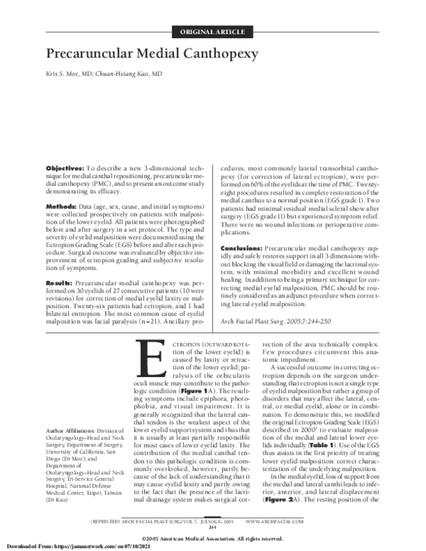 (PDF) Precaruncular Medial Canthopexy | Chuan-Hsiang Kao - Academia.edu