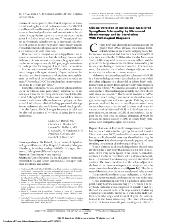 (PDF) Clinical Detection of Melanoma-Associated Spongiform Scleropathy ...