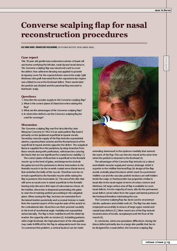 (PDF) Converse Scalping Flap for Nasal Reconstruction Procedures