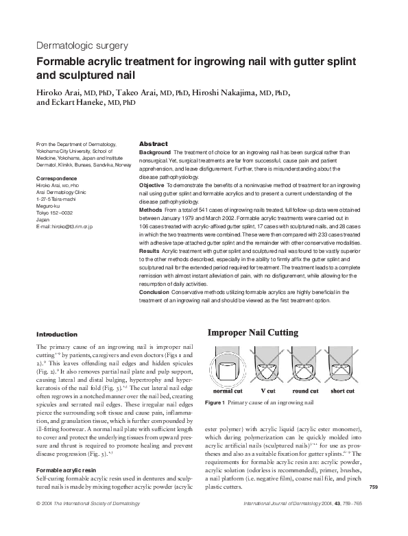(PDF) Formable acrylic treatment for ingrowing nail with gutter splint ...