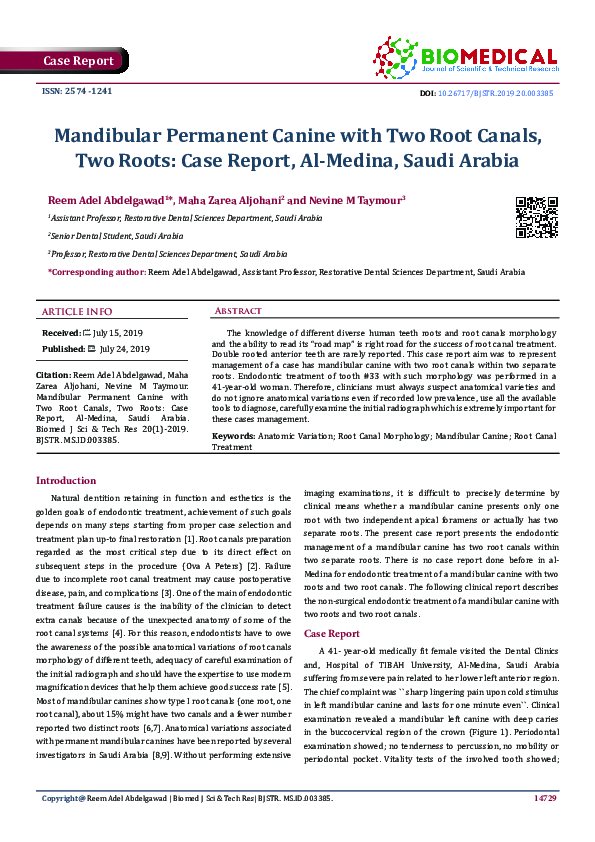 (PDF) Mandibular Permanent Canine with Two Root Canals, Two Roots: Case ...