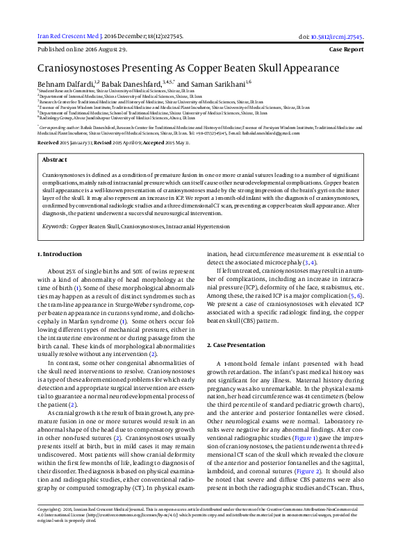 (PDF) Craniosynostoses Presenting As Copper Beaten Skull Appearance
