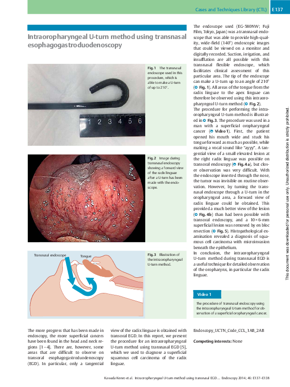 (PDF) Intraoropharyngeal U-turn method using transnasal ...