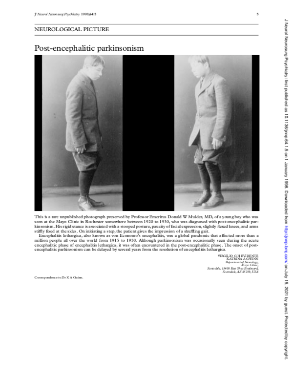 (PDF) Post-encephalitic parkinsonism