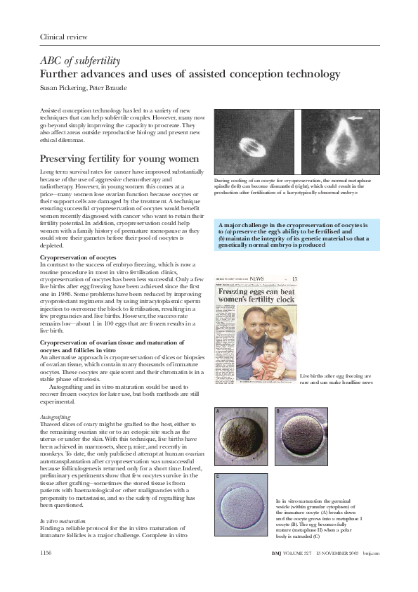 (PDF) Further advances and uses of assisted conception technology