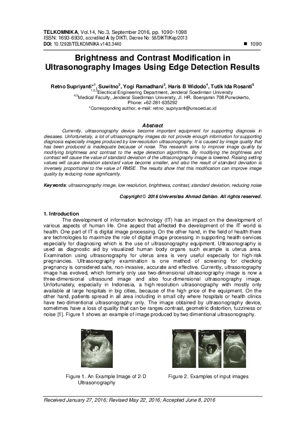 (PDF) Brightness and Contrast Modification in Ultrasonography Images ...