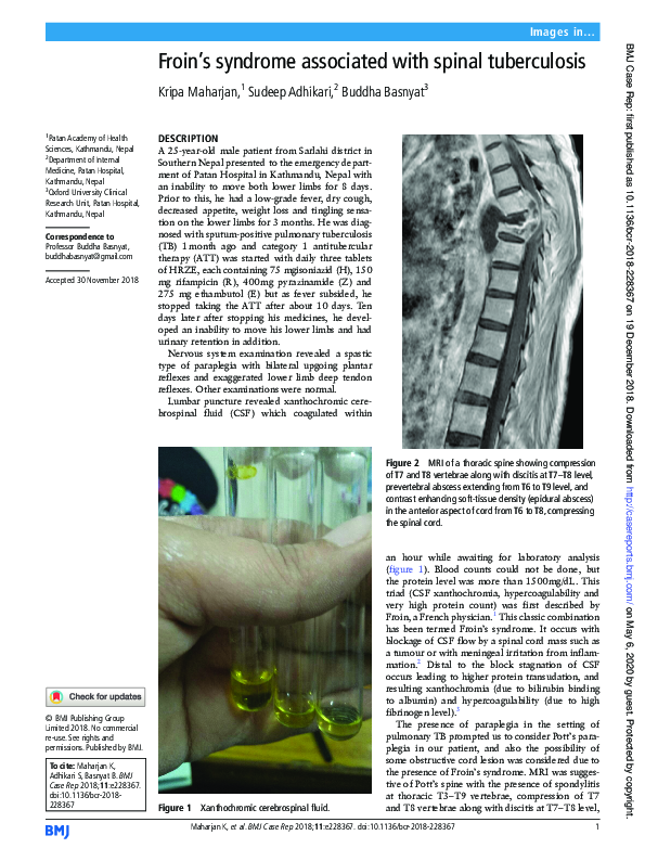 (PDF) Froin’s syndrome associated with spinal tuberculosis