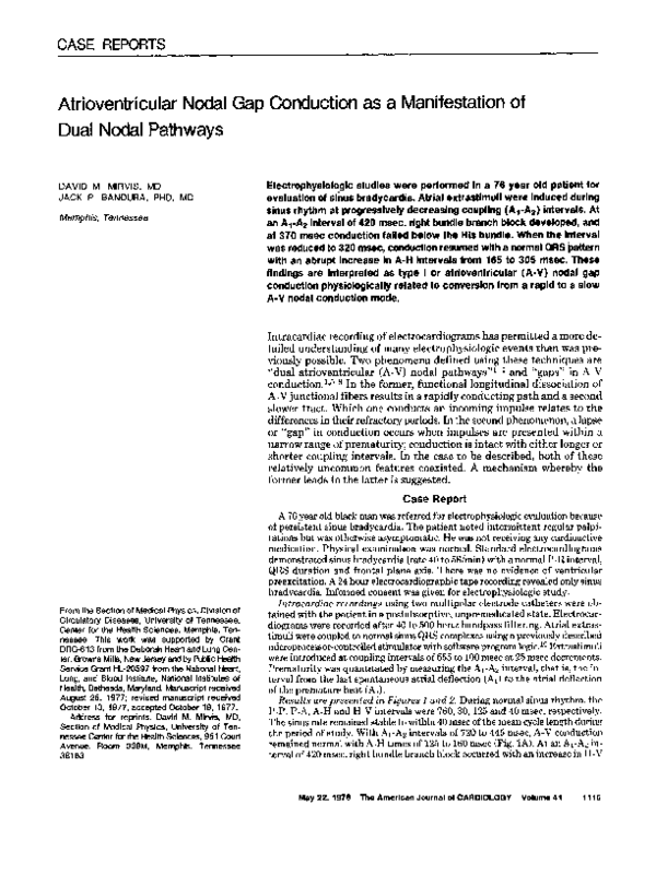 (PDF) Atrioventricular nodal gap conduction as a manifestation of dual ...