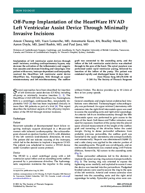 (PDF) Off-Pump Implantation of the HeartWare HVAD Left Ventricular ...