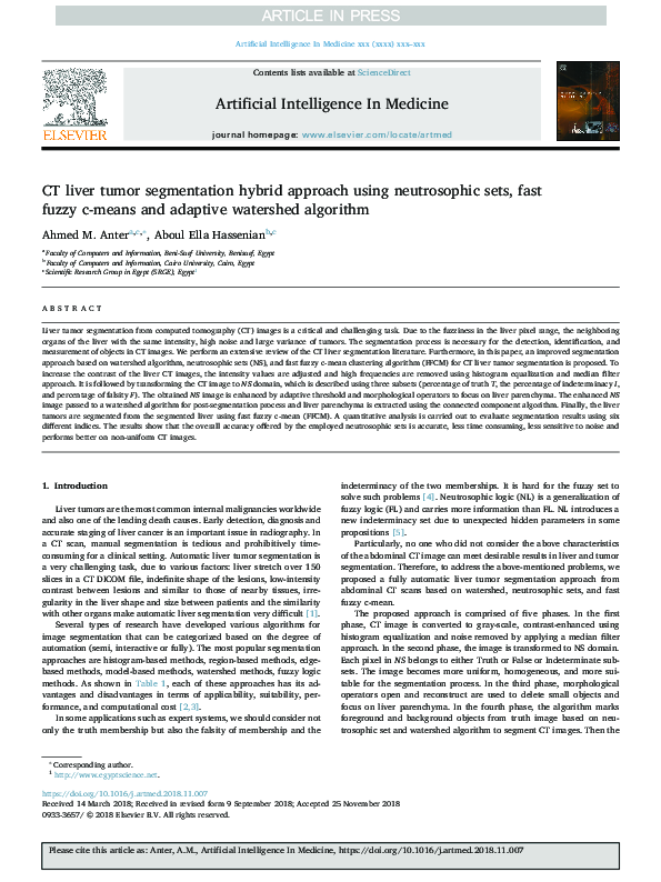 Pdf Ct Liver Tumor Segmentation Hybrid Approach Using Neutrosophic Sets Fast Fuzzy C Means