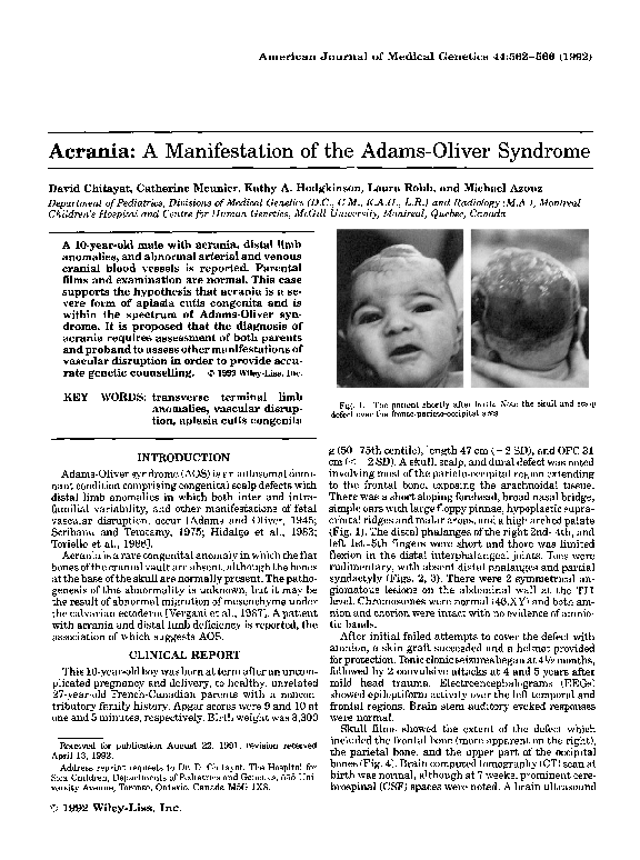 (PDF) Acrania: A manifestation of the Adams-Oliver syndrome