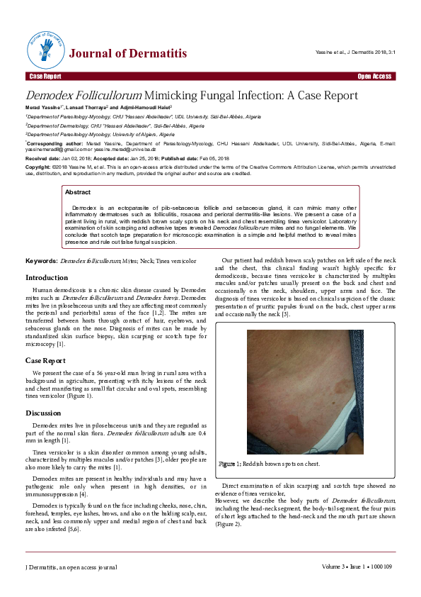 (PDF) Demodex Follicullorum Mimicking Fungal Infection: A Case Report