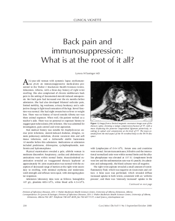 (PDF) Back pain and immunosuppression: What is at the root of it all ...
