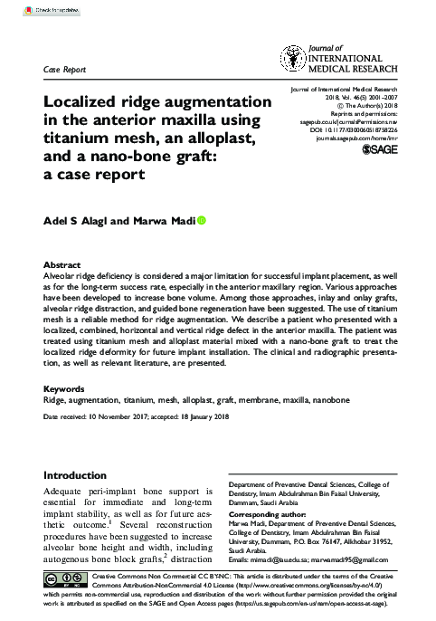 (PDF) Localized ridge augmentation in the anterior maxilla using ...