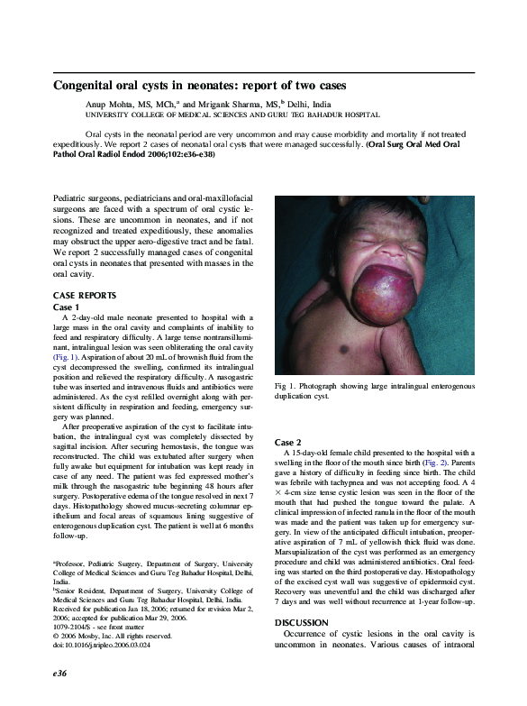(PDF) Congenital oral cysts in neonates: Report of two cases