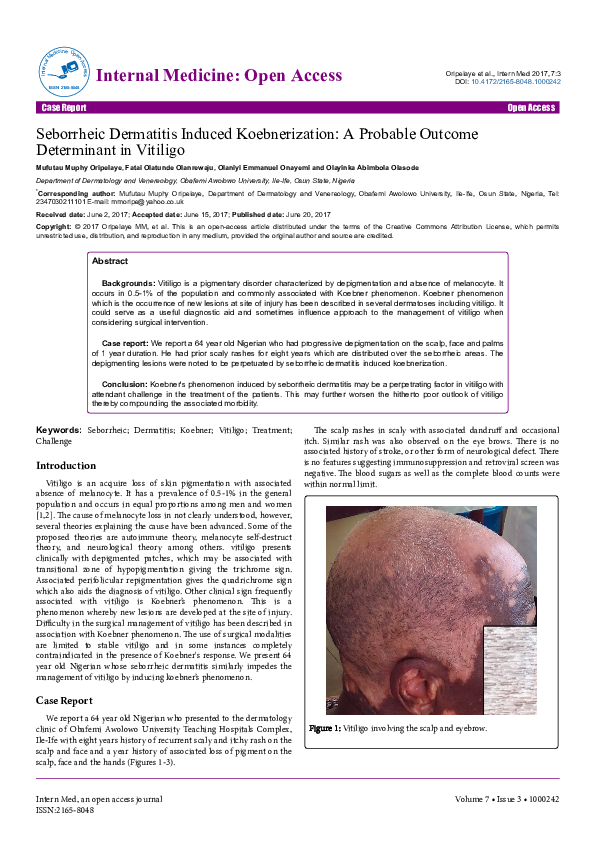 (PDF) Seborrheic Dermatitis Induced Koebnerization: A Probable Outcome ...