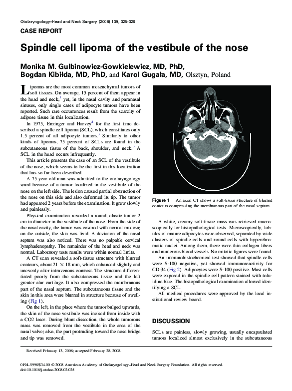 (PDF) Spindle cell lipoma of the vestibule of the nose | Bogdan Kibiłda ...