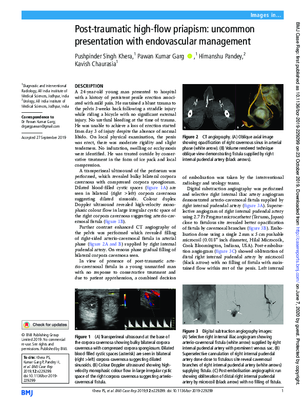 (PDF) Post-traumatic high-flow priapism: uncommon presentation with ...