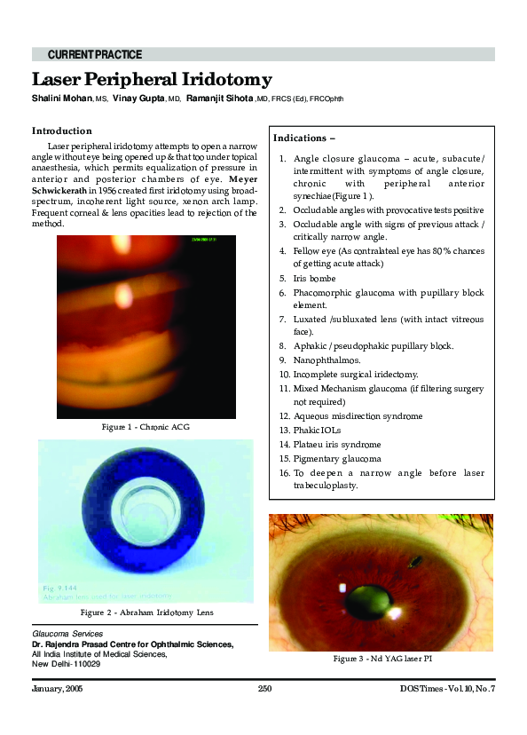 (PDF) Laser Peripheral Iridotomy