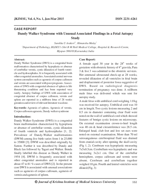 (PDF) Dandy Walker Syndrome with Unusual Associated Findings in a Fetal ...