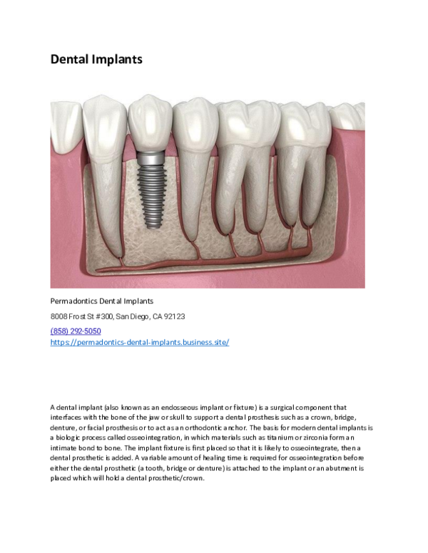 (PDF) Dental Implants