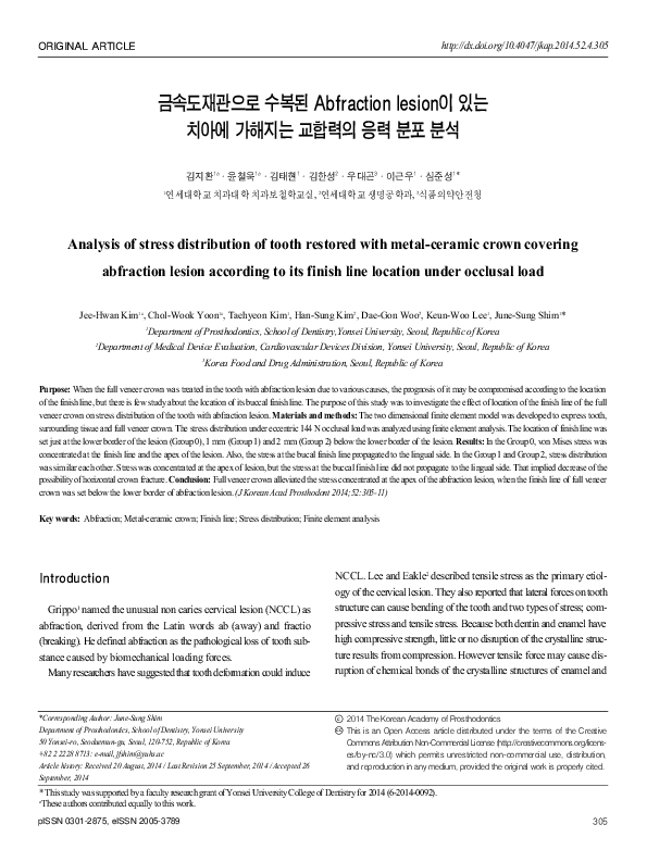 Pdf Analysis Of Stress Distribution Of Tooth Restored With Metal Ceramic Crown Covering