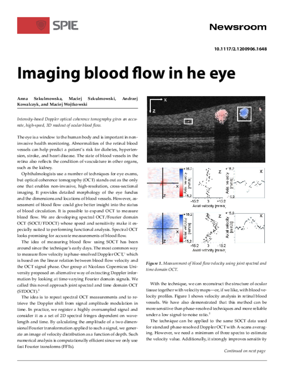 (PDF) Imaging blood flow in the eye