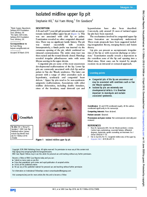 (PDF) Isolated midline upper lip pit | Tim Goodacre - Academia.edu