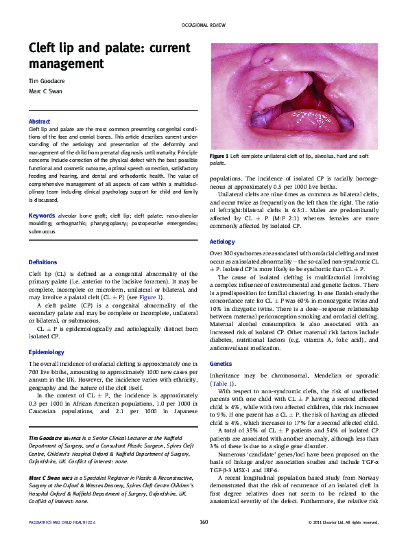 (PDF) Cleft lip and palate: current management