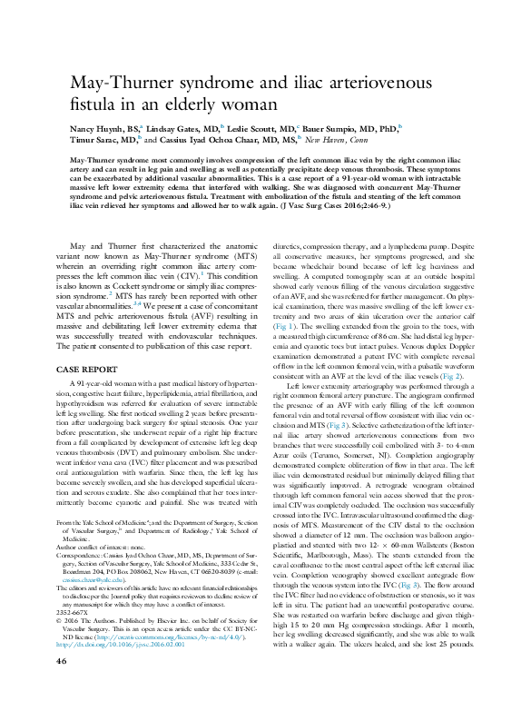 (PDF) May-Thurner syndrome and iliac arteriovenous fistula in an ...