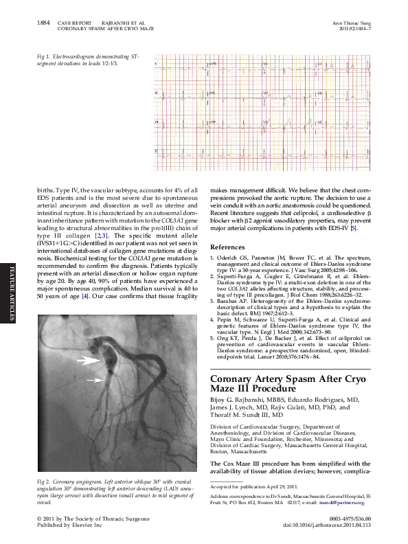 (PDF) Coronary Artery Spasm After Cryo Maze III Procedure