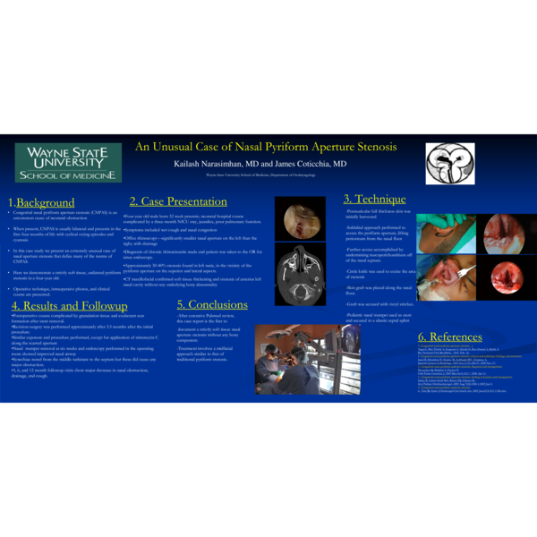(PDF) An Unusual Case of Nasal Pyriform Aperture Stenosis