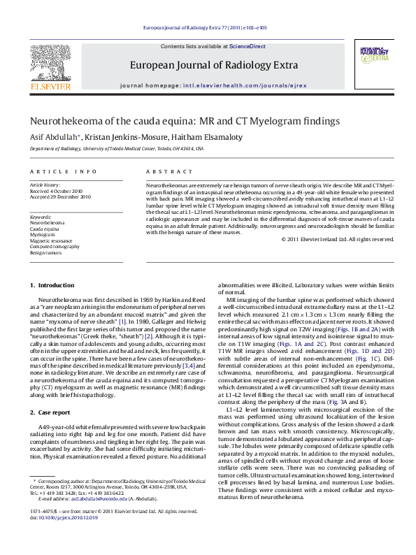 (PDF) Neurothekeoma of the cauda equina: MR and CT Myelogram findings