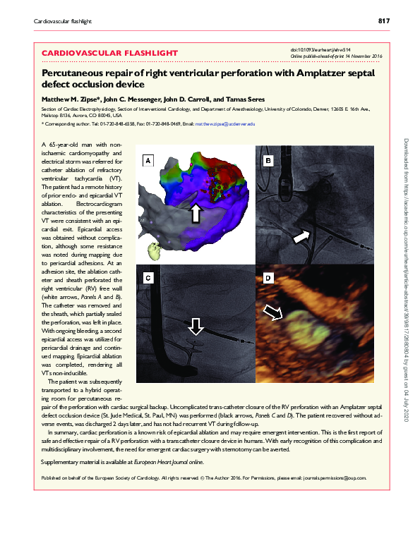 (PDF) Percutaneous repair of right ventricular perforation with ...