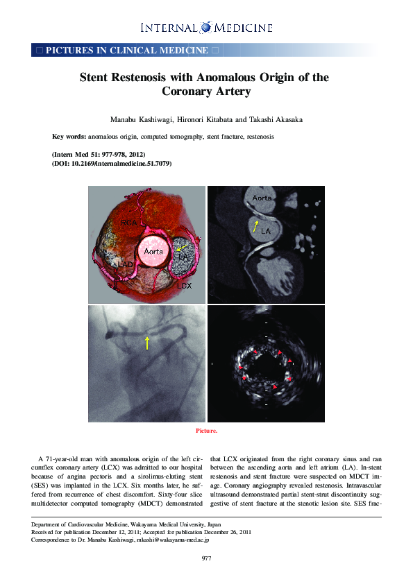 (PDF) Stent Restenosis with Anomalous Origin of the Coronary Artery