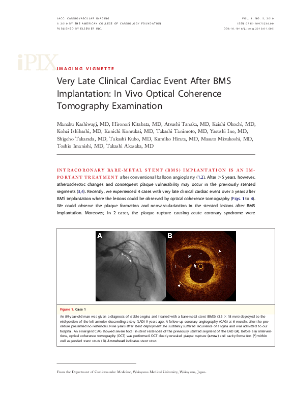(PDF) Very Late Clinical Cardiac Event After BMS Implantation: In Vivo ...