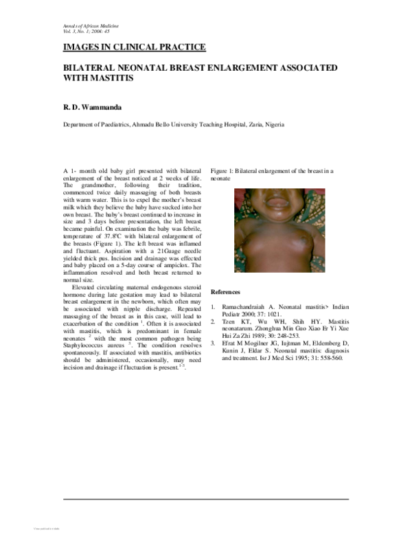 (PDF) Bilateral Neonatal Breast Enlargement Associated with Mastitis