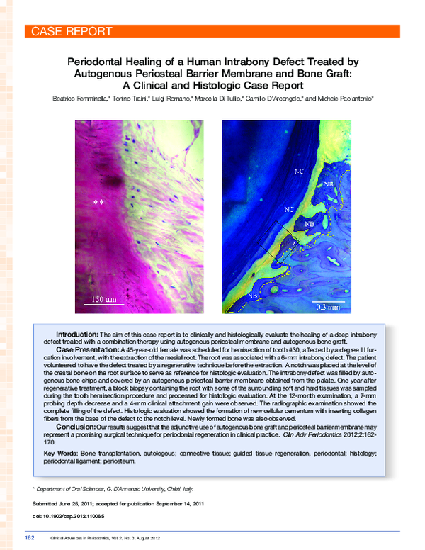 (PDF) Periodontal Healing of a Human Intrabony Defect Treated by ...