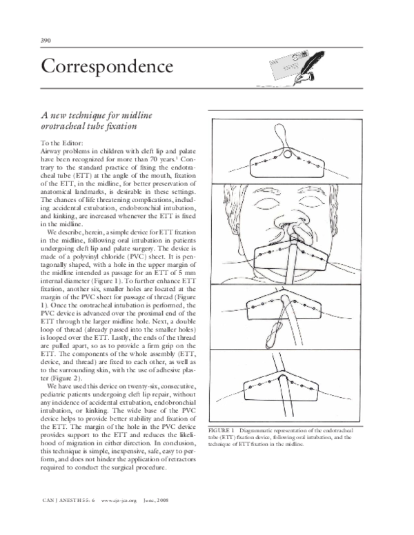 (PDF) A new technique for midline orotracheal tube fixation