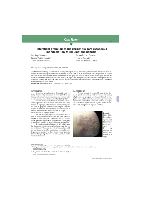 (PDF) Interstitial granulomatous dermatitis: rare cutaneous ...