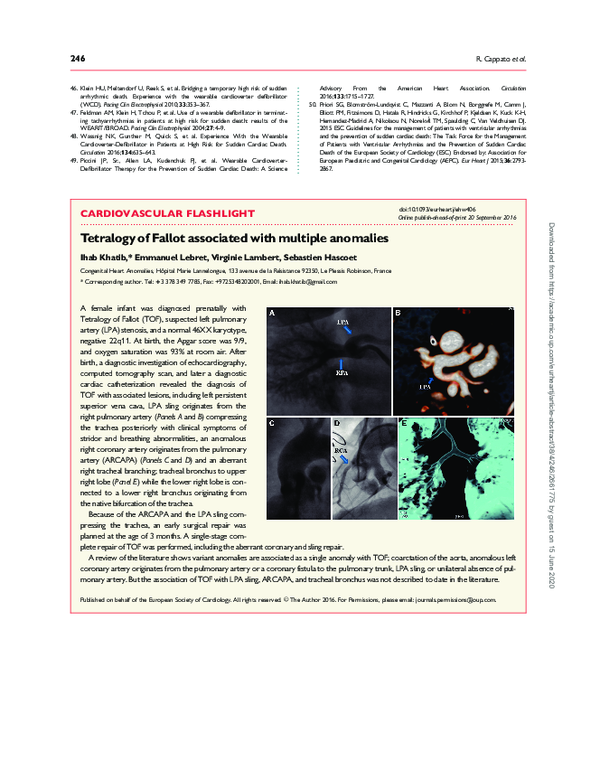 (PDF) Tetralogy of Fallot associated with multiple anomalies