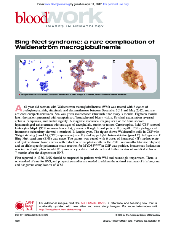 (PDF) Bing-Neel syndrome: a rare complication of Waldenstrom macroglobulinemia
