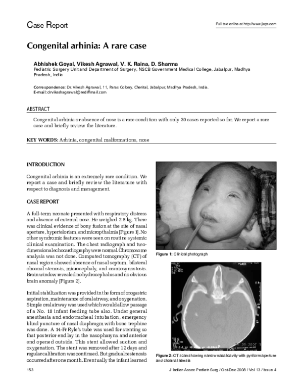 (PDF) Congenital arhinia: A rare case