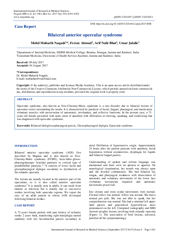 (PDF) Bilateral anterior opercular syndrome