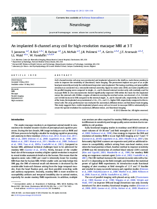 (PDF) An implanted 8-channel array coil for high-resolution macaque MRI ...