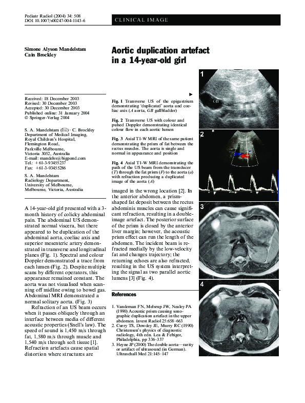 (PDF) Aortic duplication artefact in a 14-year-old girl | Simone ...