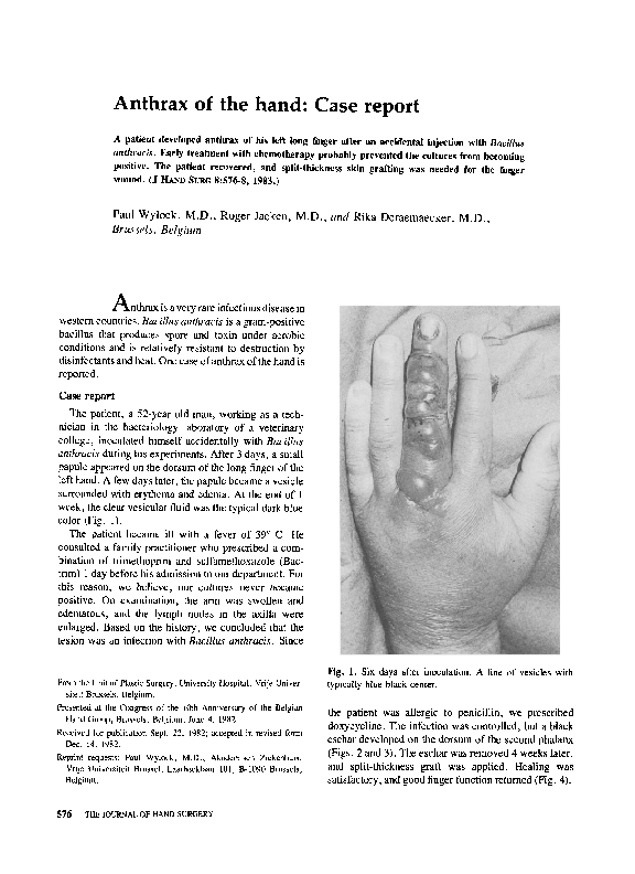 (PDF) Anthrax of the hand: case report