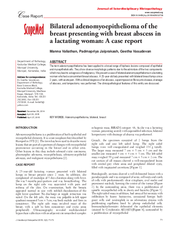 (PDF) Bilateral Adenomyoepithelioma of the Breast Presenting With ...