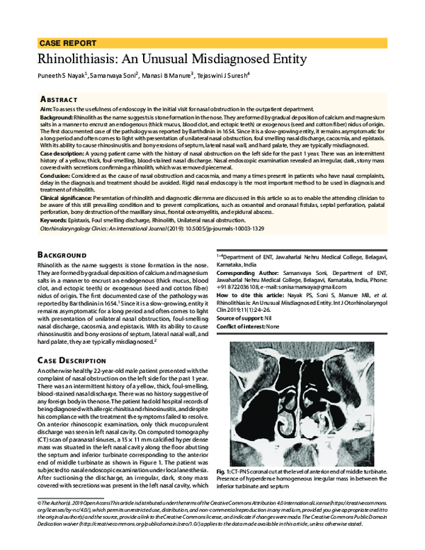 (PDF) Rhinolithiasis: An Unusual Misdiagnosed Entity | Samanvaya Soni ...